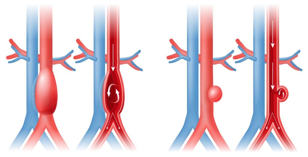 Conditions and Procedures | Western Sydney Vascular - Westmead and ...